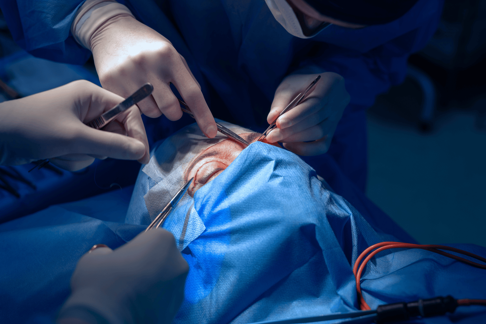 Best Surgical Loupes for Surgeons – LumaDent